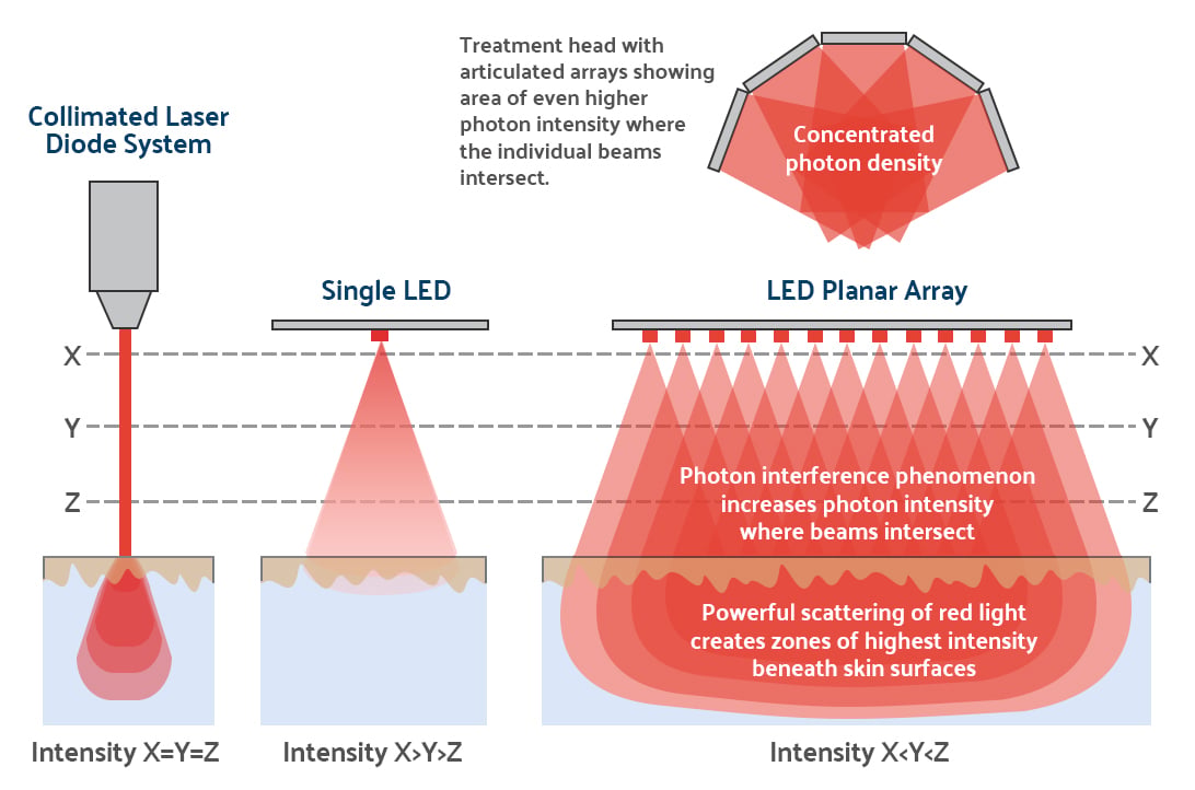Photobiomodulation Light Tissue Interaction And The Current And